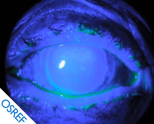 Amniotic Membrane Transplantation for Corneal Indications - Osref