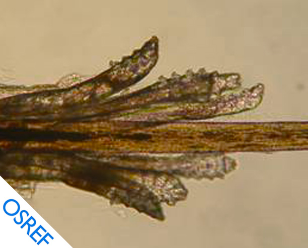 Demodex Blepharitis: Diagnosis and Treatment - Osref